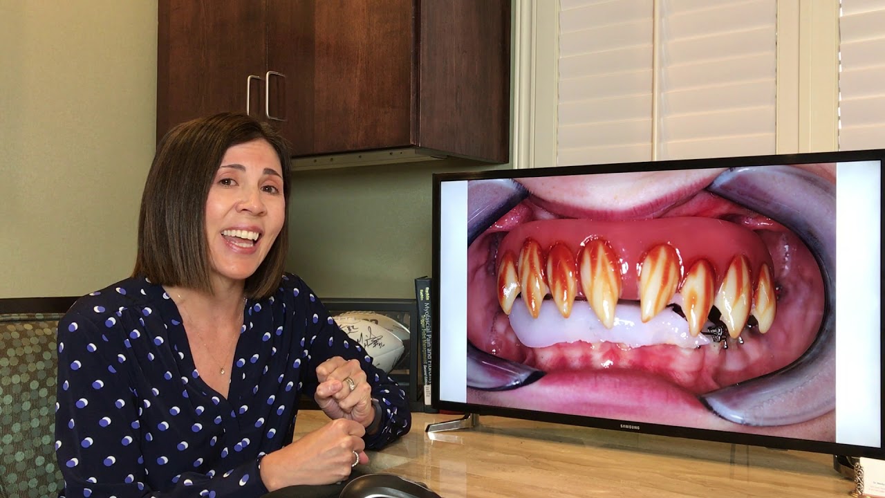 Scary Teeth Story at Halloween - YouTube