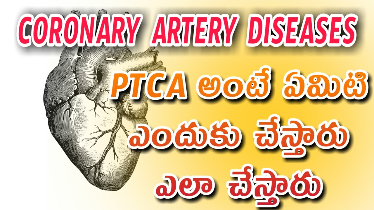 [ PTCA ] Percutaneous transluminal coronary angioplasty EXPLAINED IN ...