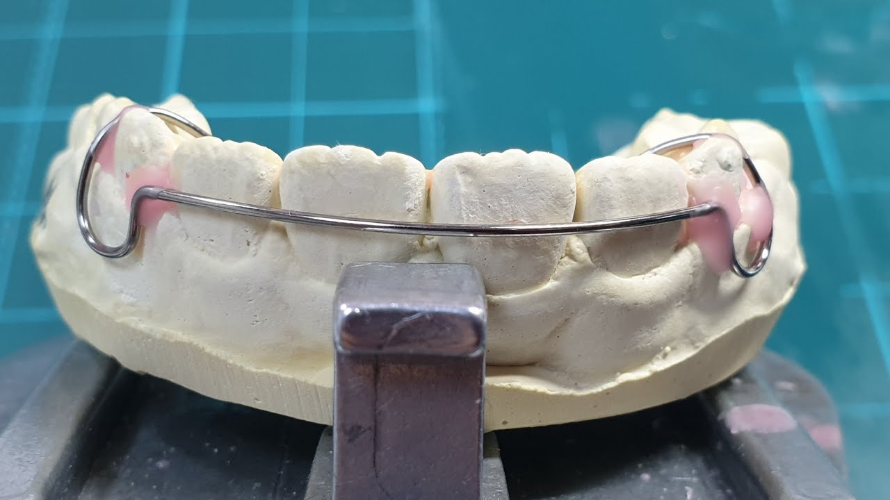 labial bow wire bending /retainer - YouTube