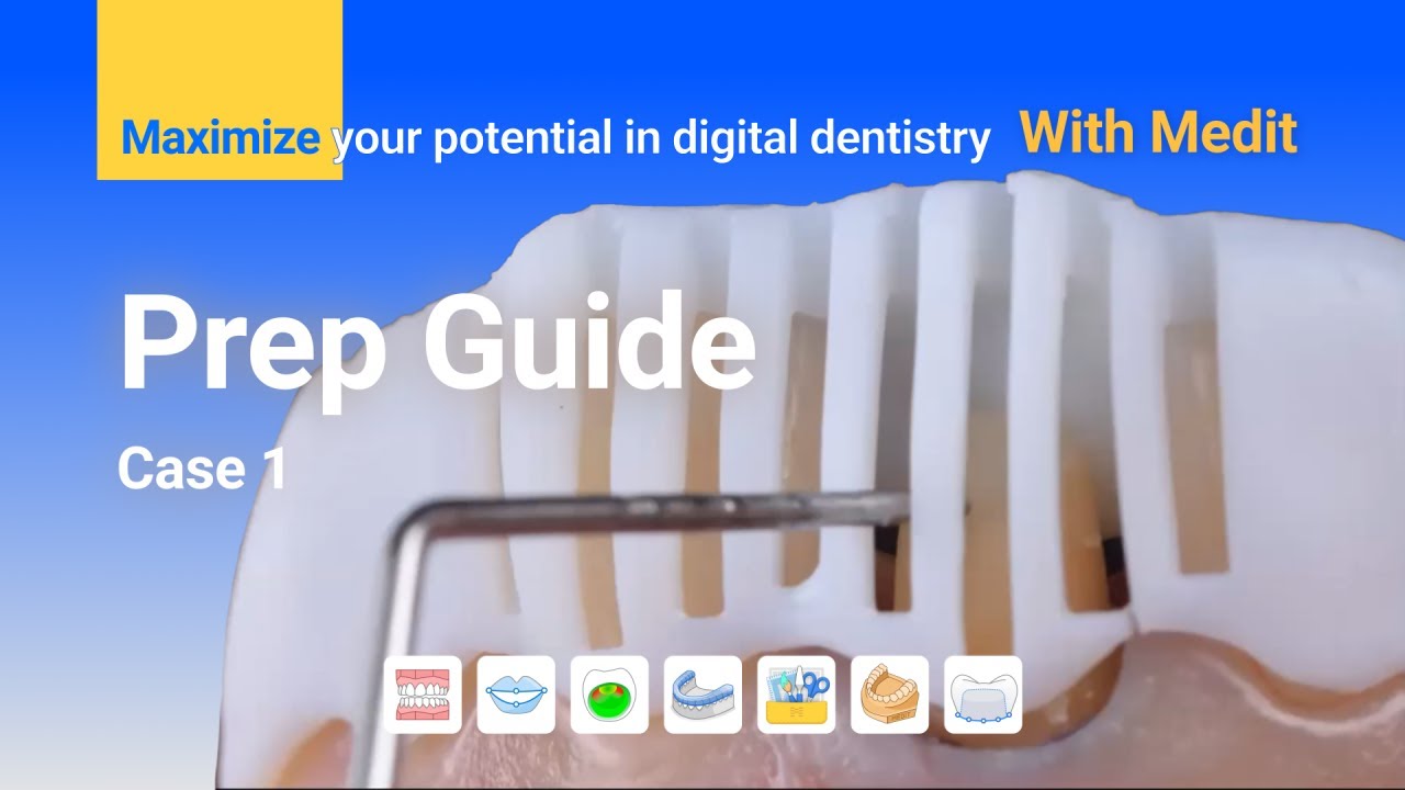 Prep Guide - Case 1 - YouTube