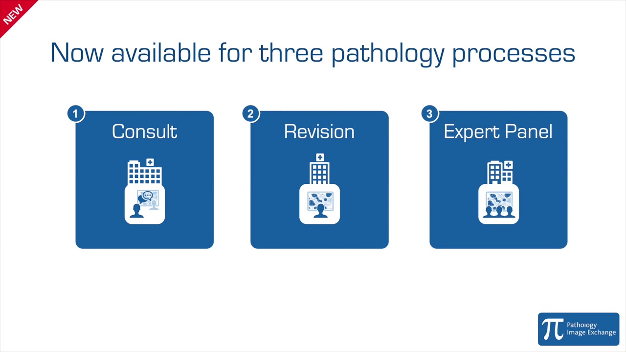 PIE animation EN v1 1 - YouTube