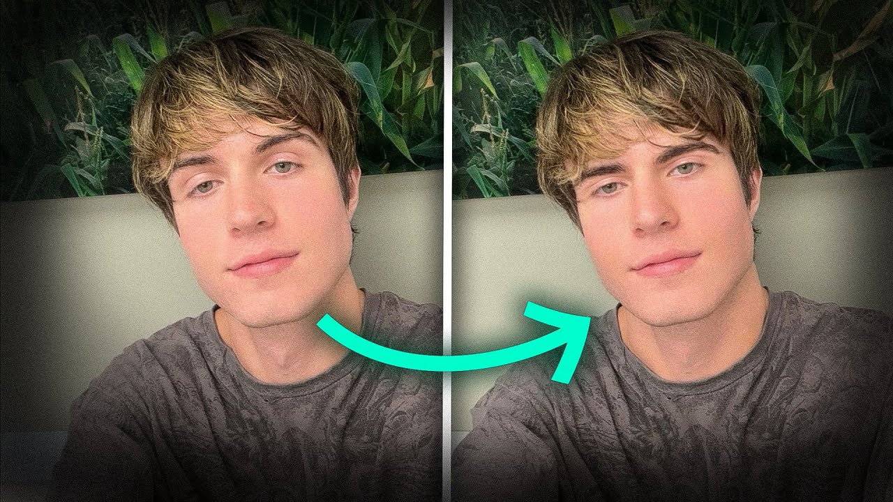 My Full Looksmaxxing Surgery Plan (Complete Breakdown) - YouTube