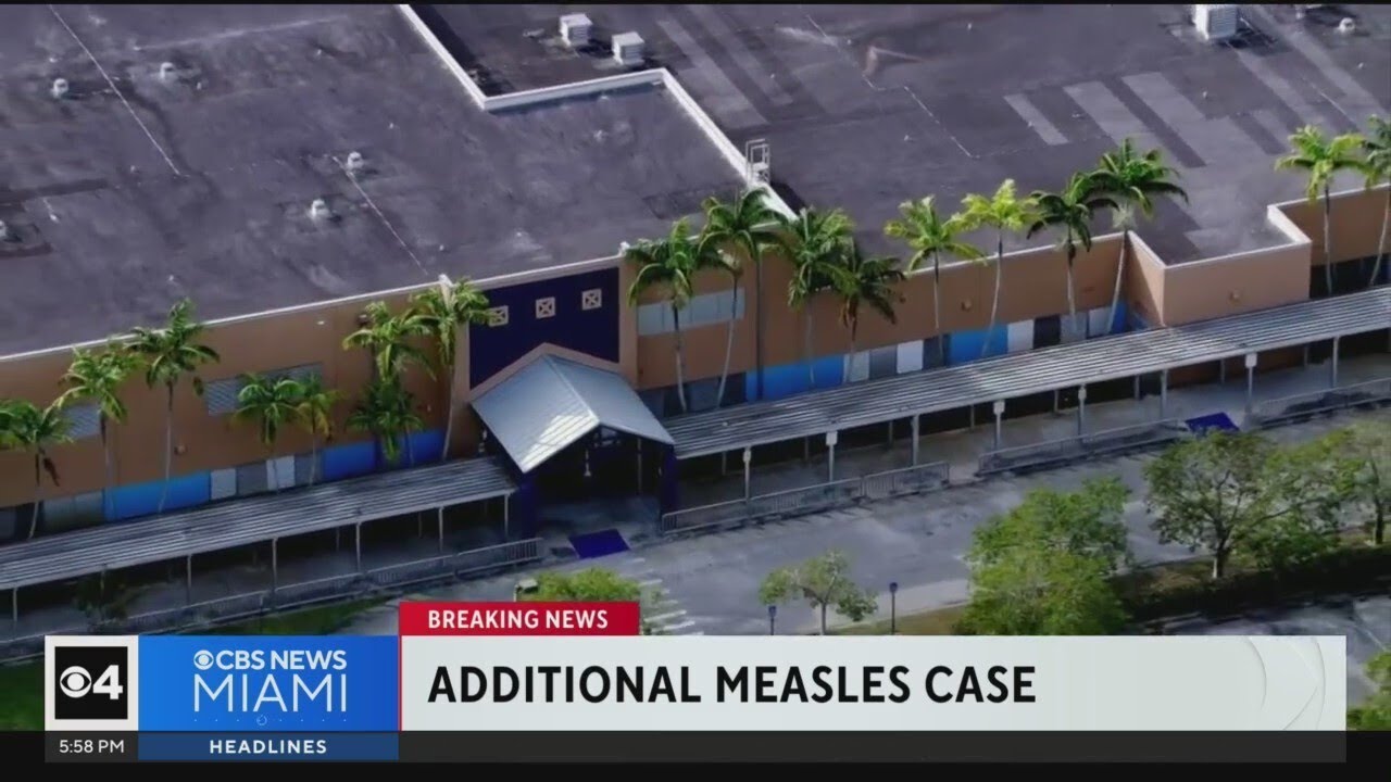 5th case of measles detected in Broward, Florida Department of Health ...