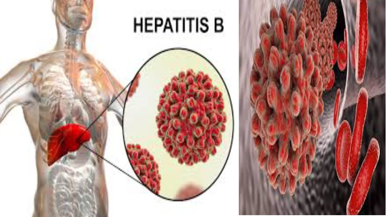 traitement hépatite b info appel, Watsap 00221778995655/00221765489692 ...
