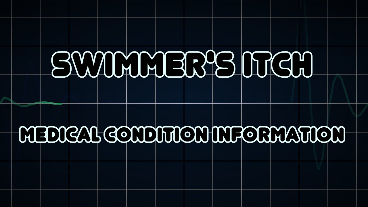 Swimmer's itch (Medical Condition) - YouTube