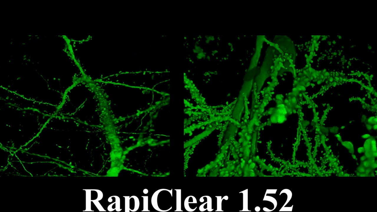 CA1 neurons and a single neuron in mouse brain - YouTube