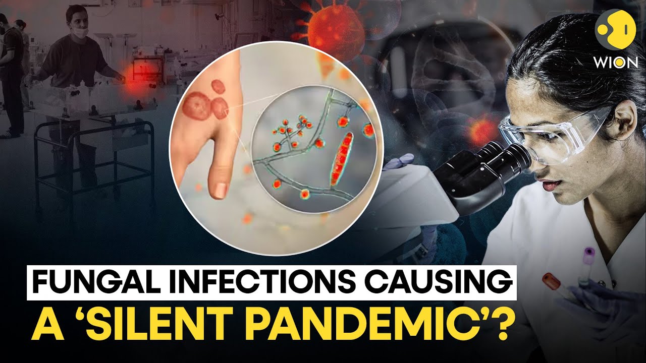 Scientists Warn Deadly Fungal Infections Are Causing A 'Silent Pandemic ...