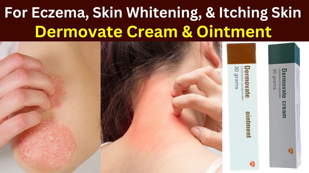 Dermovate cream how to use | Dermovate cream for eczema | Dermovate ...