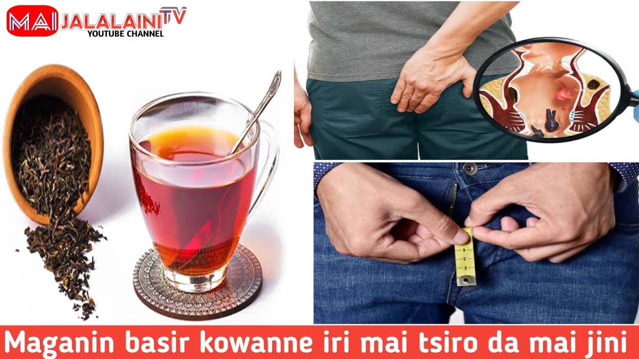 Maganin basir kowanne iri, kankancewar gaba da Raunin gaba. - YouTube