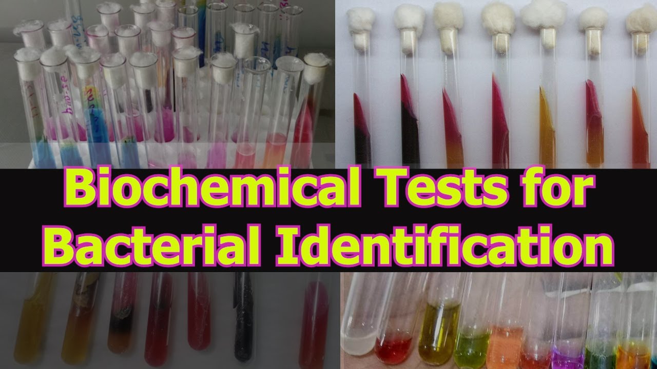 BIOCHEMICAL TESTS FOR BACTERIAL IDENTIFICATION - YouTube