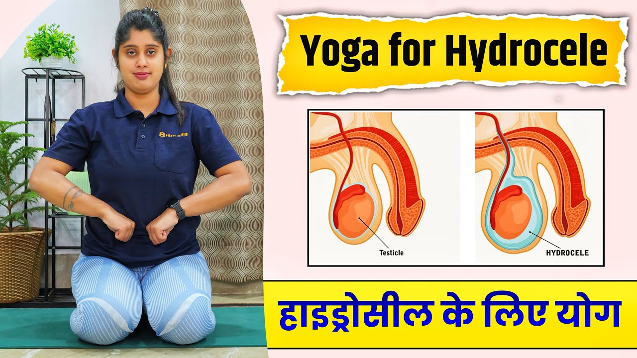 पुरुषों में हाइड्रोसील को ठीक करने के लिए योगासन | Yoga for Hydrocele ...