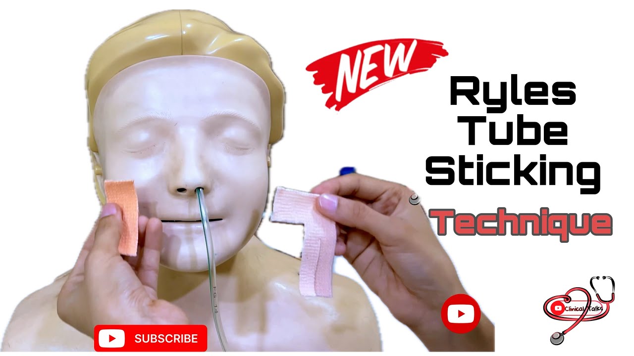 Ryles Tube Sticking Technique @ClinicalTalks - YouTube