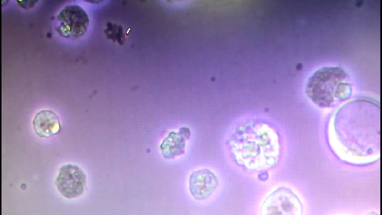 Cell culture contamination (need help to verify) - YouTube