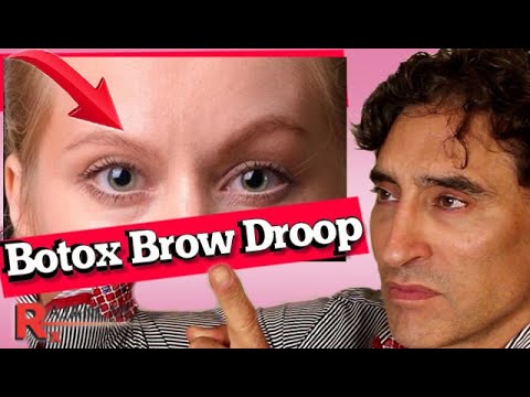 BOTOX BROW DROOP - Brow Tutorial - YouTube