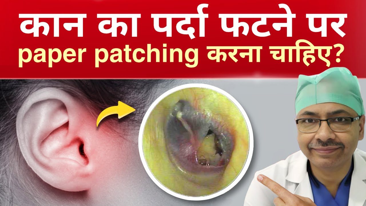 Kan ka parda fatne par paper patching karna kya thik hai? - YouTube