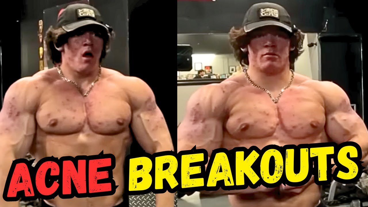 Sam Sulek is killing his health! Why? - YouTube