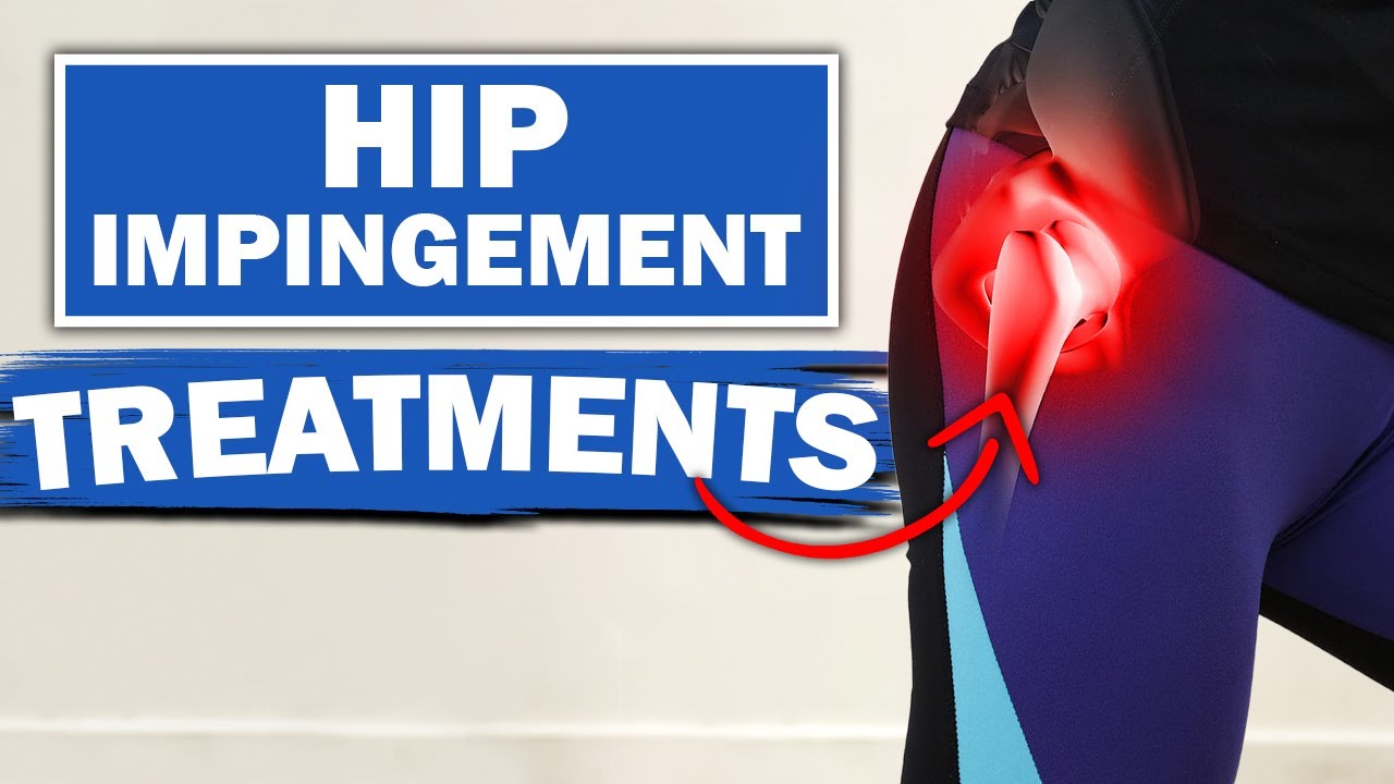 Hip Femoral Acetabular Impingement (FAI) - 16 Exercises & Treatment ...