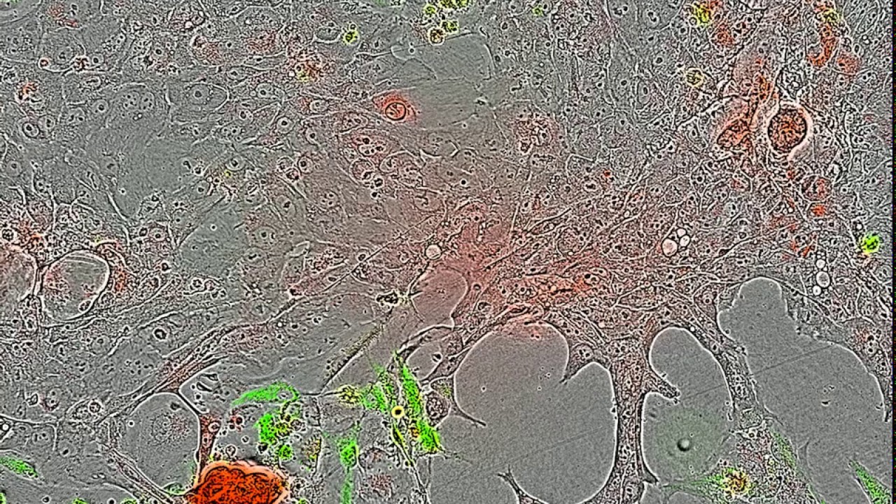 MCf10A-NeuN Co-culture(red) with HUVEC(green)- Incucyte Zoom 2016 - YouTube