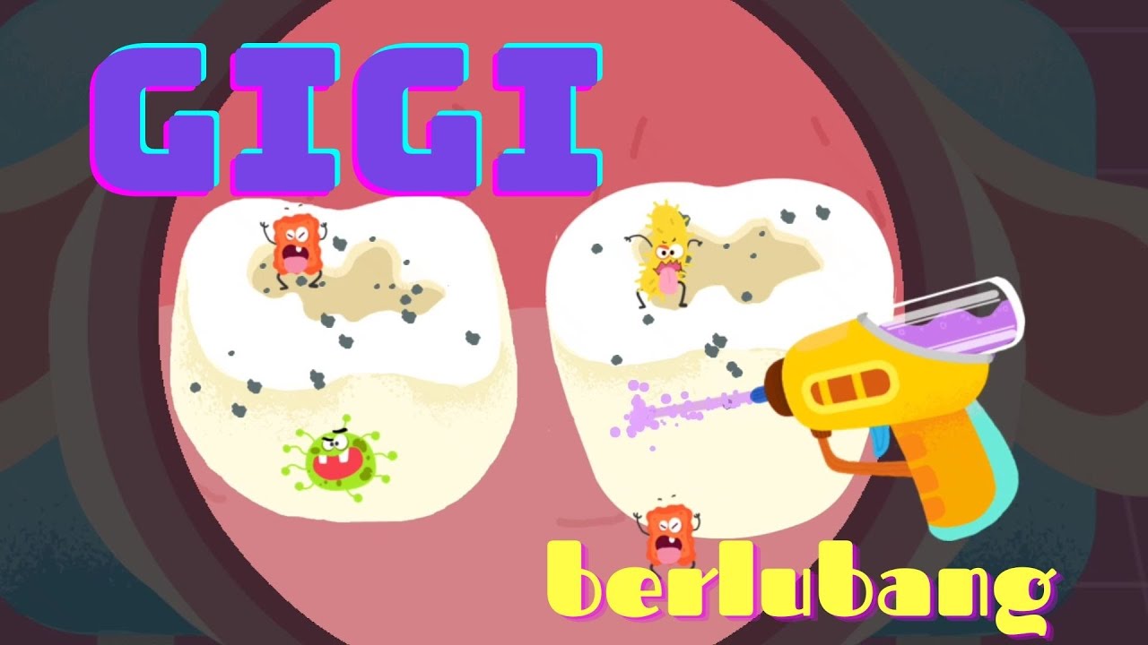 perawatan gigi berlubang | bermain game baby bus , game android baby ...