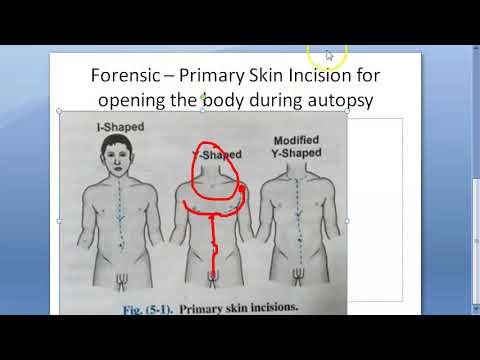 Forensic 050 a I shape Incision Y modified technique Autopsy Medico Legal Postmortem