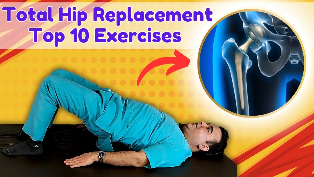 Top 10 Must-Do Exercises After Total Hip Replacement for a Faster ...