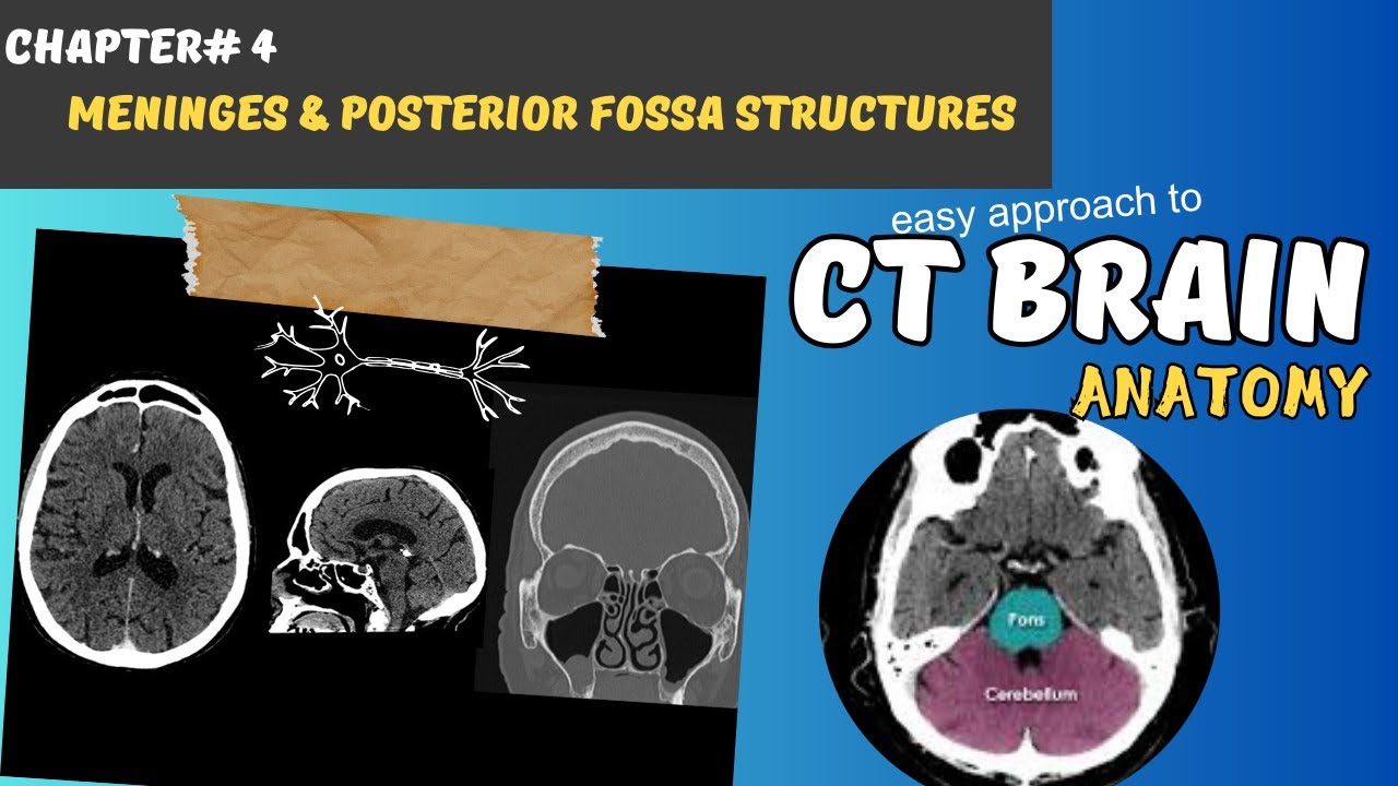 Meninges & Posterior fossa structures (Cerebellum & Brainstem) |CT ...