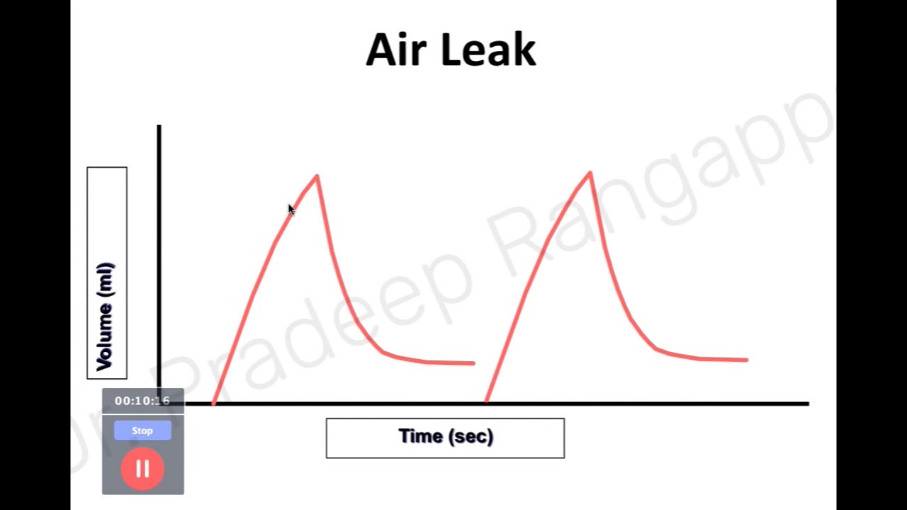 Scalars - Mechanical Ventilation Basic Concepts | Dr. Pradeep Rangappa ...