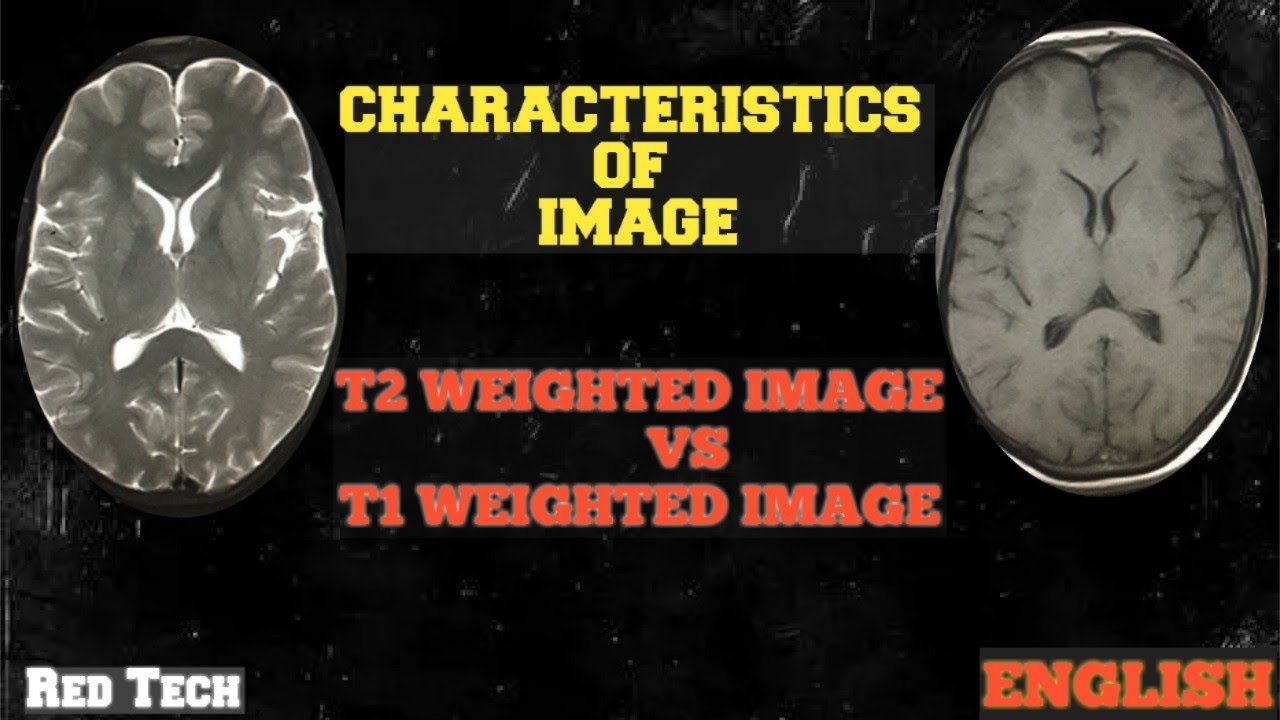 MRI || T2 vs T1 WEIGHTED IMAGE || ENGLISH || - YouTube
