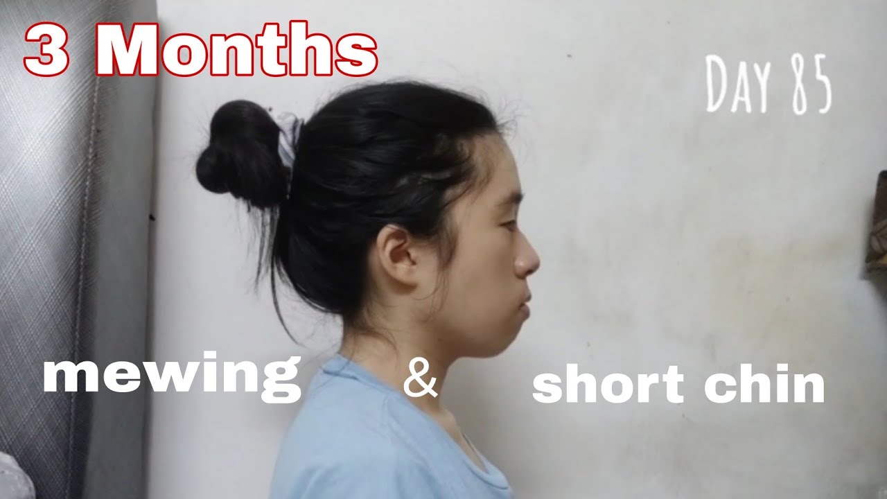 3 months MEWING & SHORT CHIN exercises | fixing receding chin # ...
