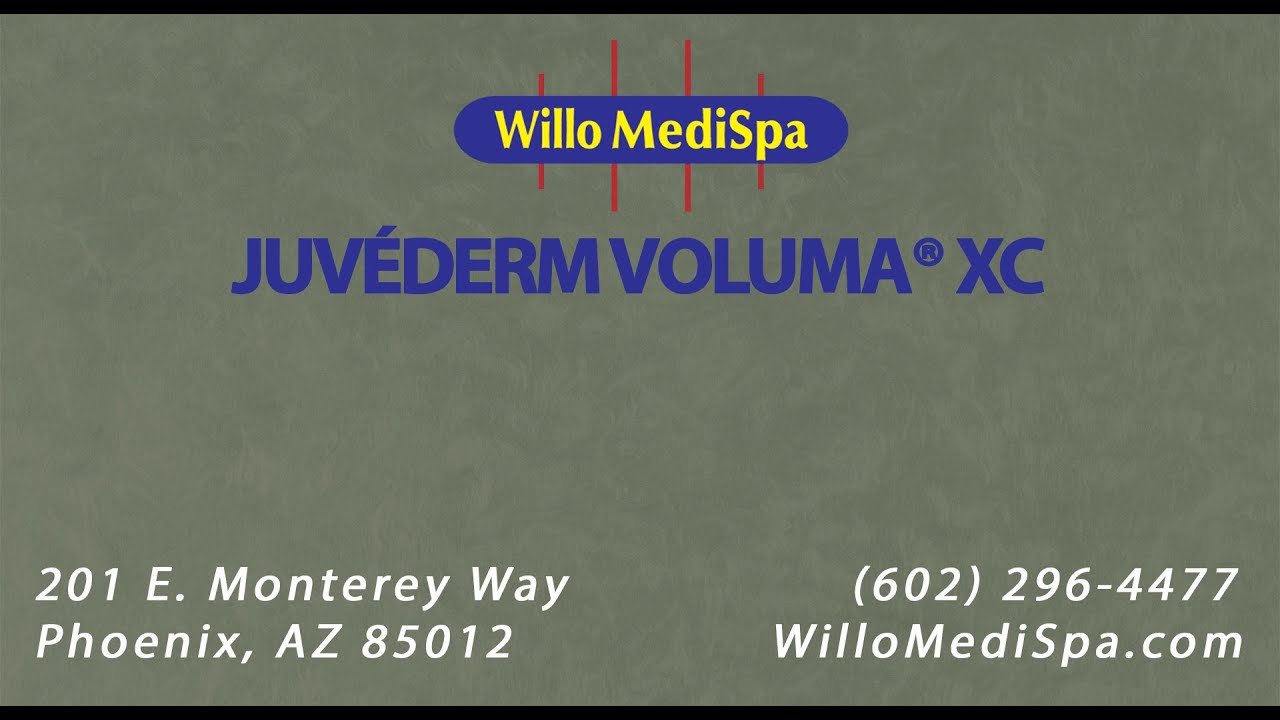JUVÉDERM Voluma® XC | Willo MediSpa - YouTube