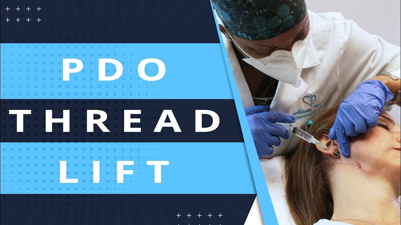 PDO Thread Neck Lift: Are PDO Threads A Good Alternative To Surgery? # ...
