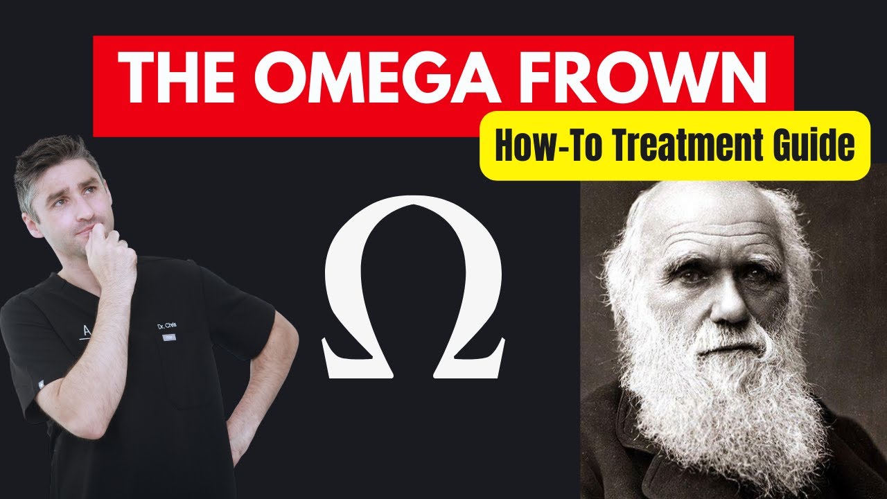 Botox Injecting Patterns Forehead - An 'Omega' Frown Pattern | Dr Chris ...