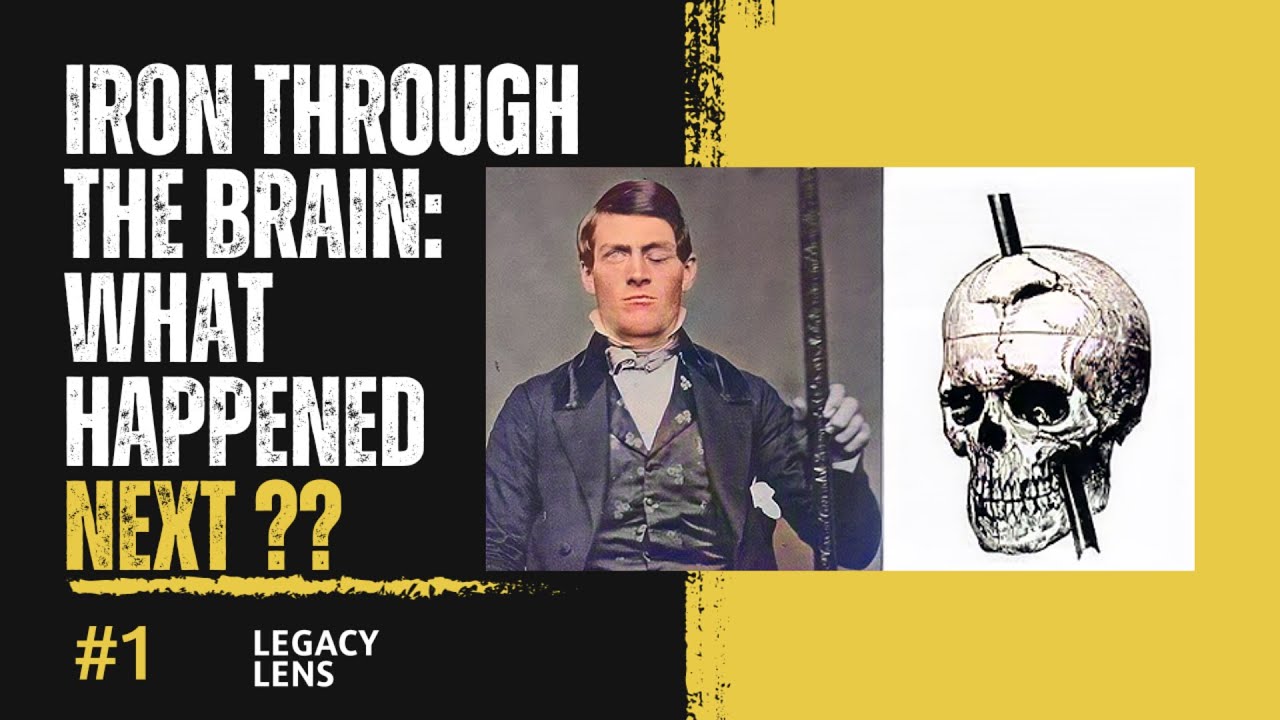 IRON THROUGH BRAIN: THE PHINEAS GAGE STORY - YouTube