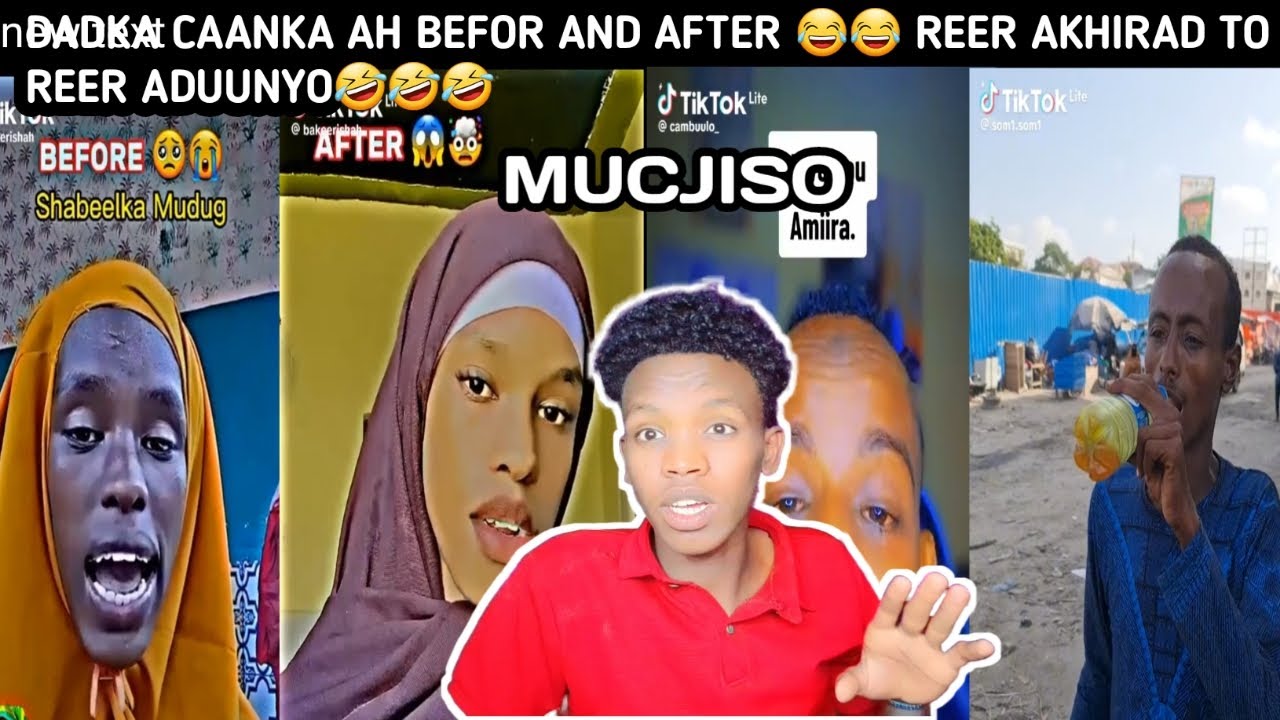 DADKA CAANKA AH BEFORE AND AFTER WAXBA KA DHCAY MEESHA 😂😂 REER AKHIRAAD ...