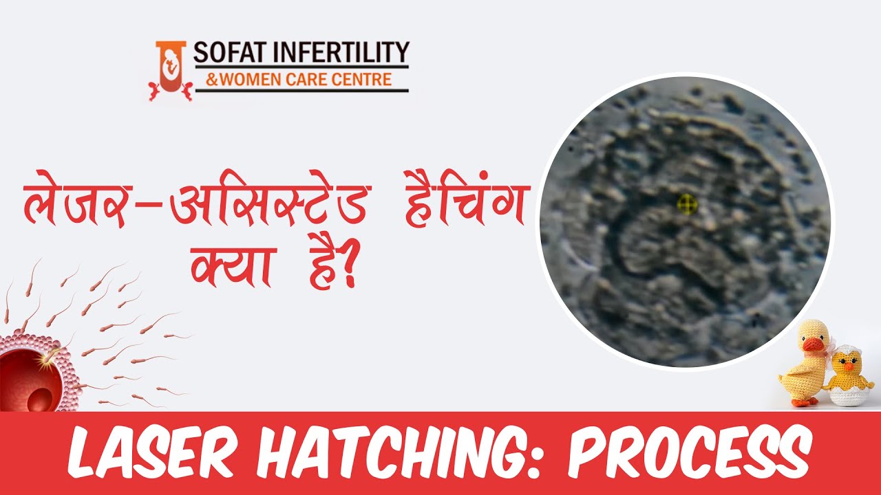 Laser Hatching: 2000+ Successful Pregnancies Punjab's first IVF Centre ...