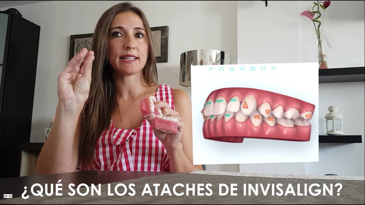 Ataches invisalign - YouTube