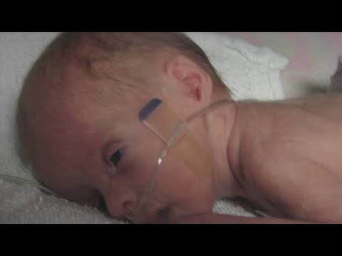 L'hydrocéphalie - partie 02 (Clinique, Paraclinique) - YouTube