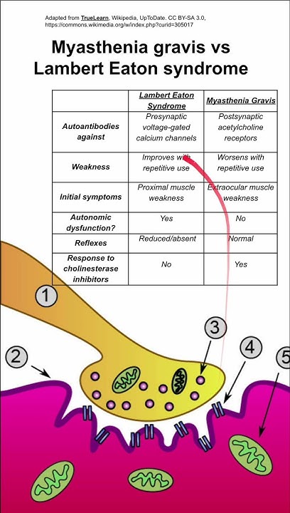 Myasthenia gravis vs Lambert Eaton syndrome - YouTube