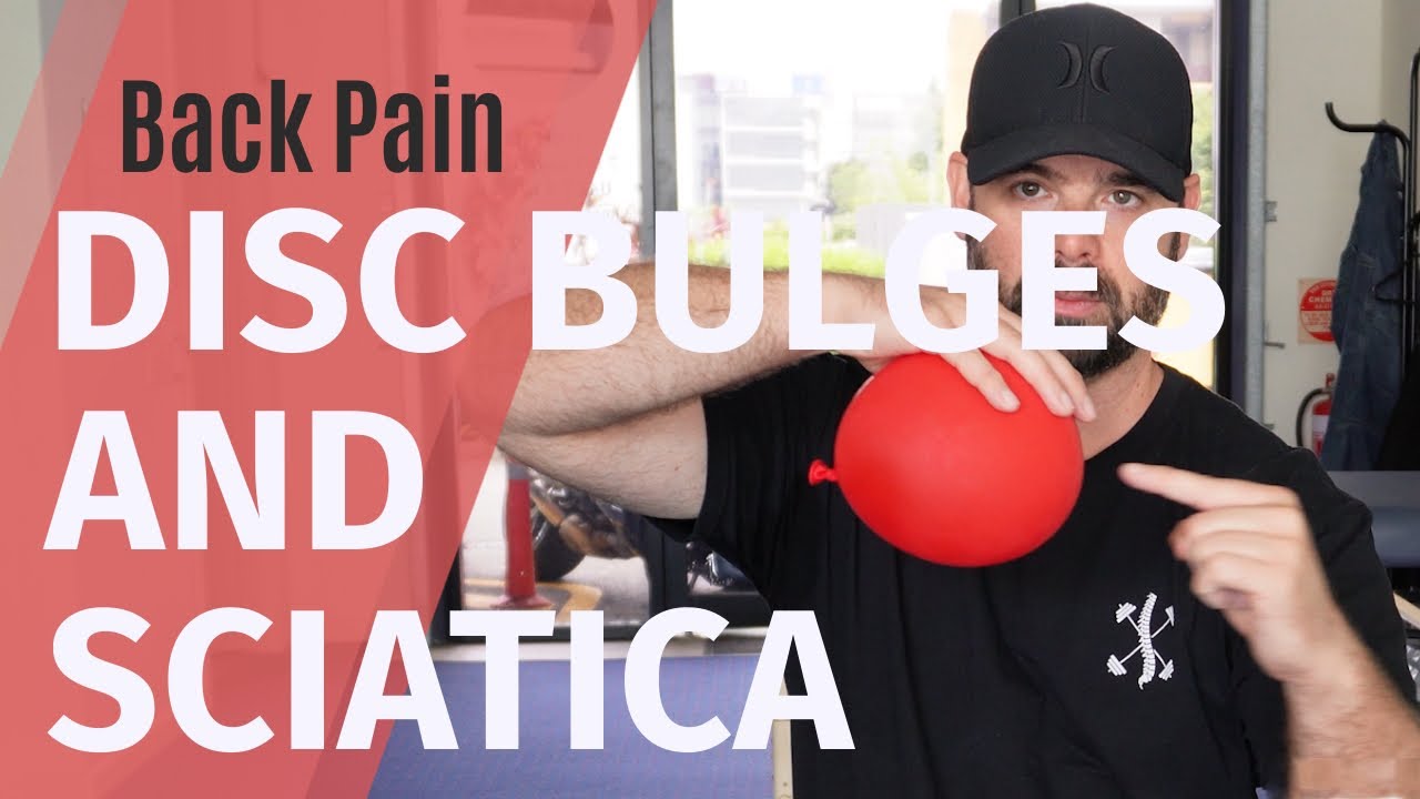Healing Disc Bulges and Sciatica - Part 1 - YouTube