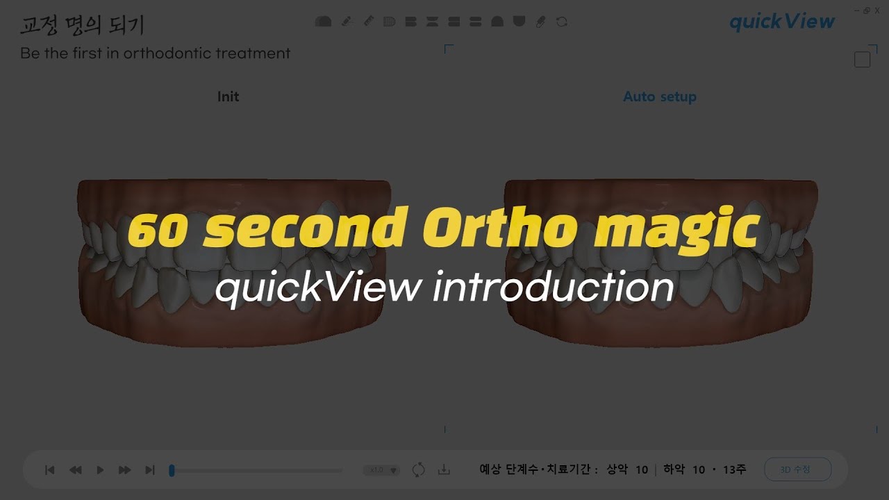 quickView introduction - YouTube