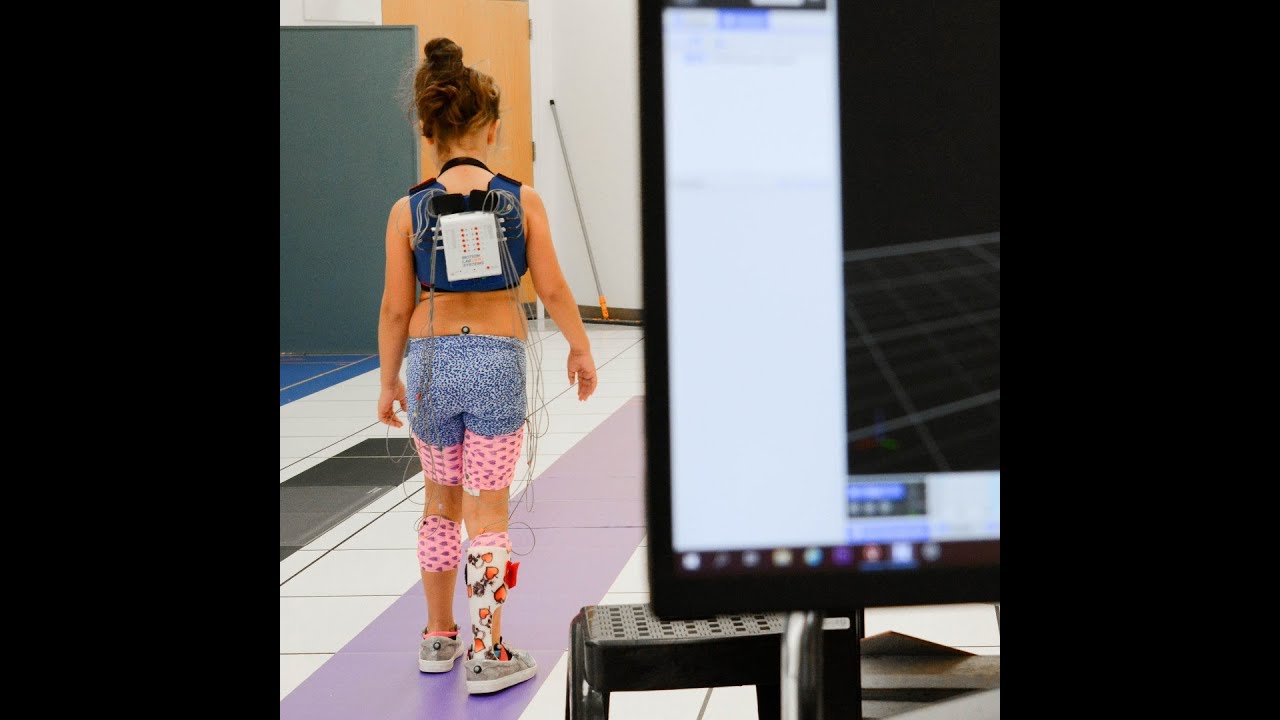 Shriners Children's Motion Analysis Center Webinar - YouTube