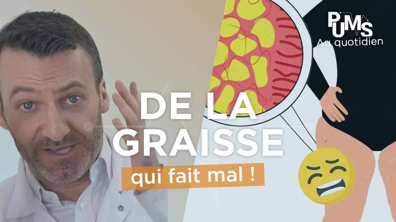 De GROSSES JAMBES qui font MAL : on vous explique le lipoedème - YouTube