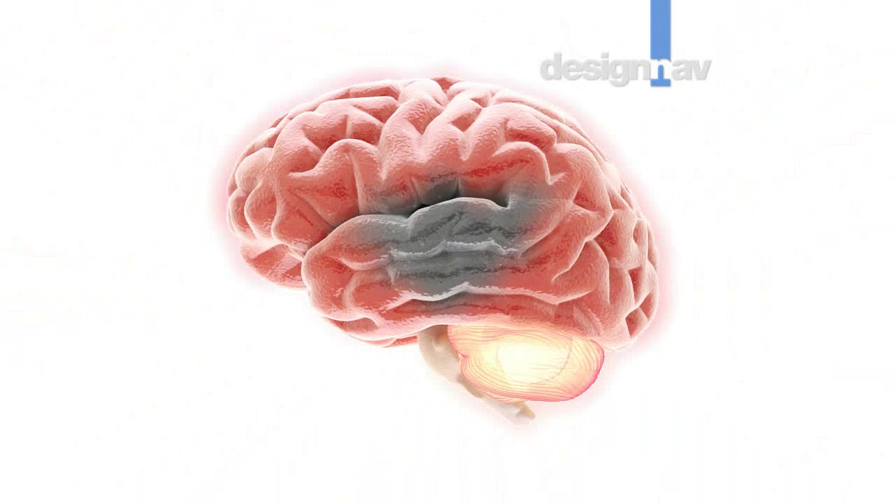 Cerevate Medical Animation - YouTube