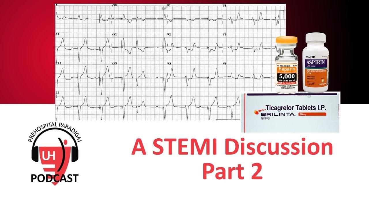 EMS STEMI Discussion, Part 2 - YouTube