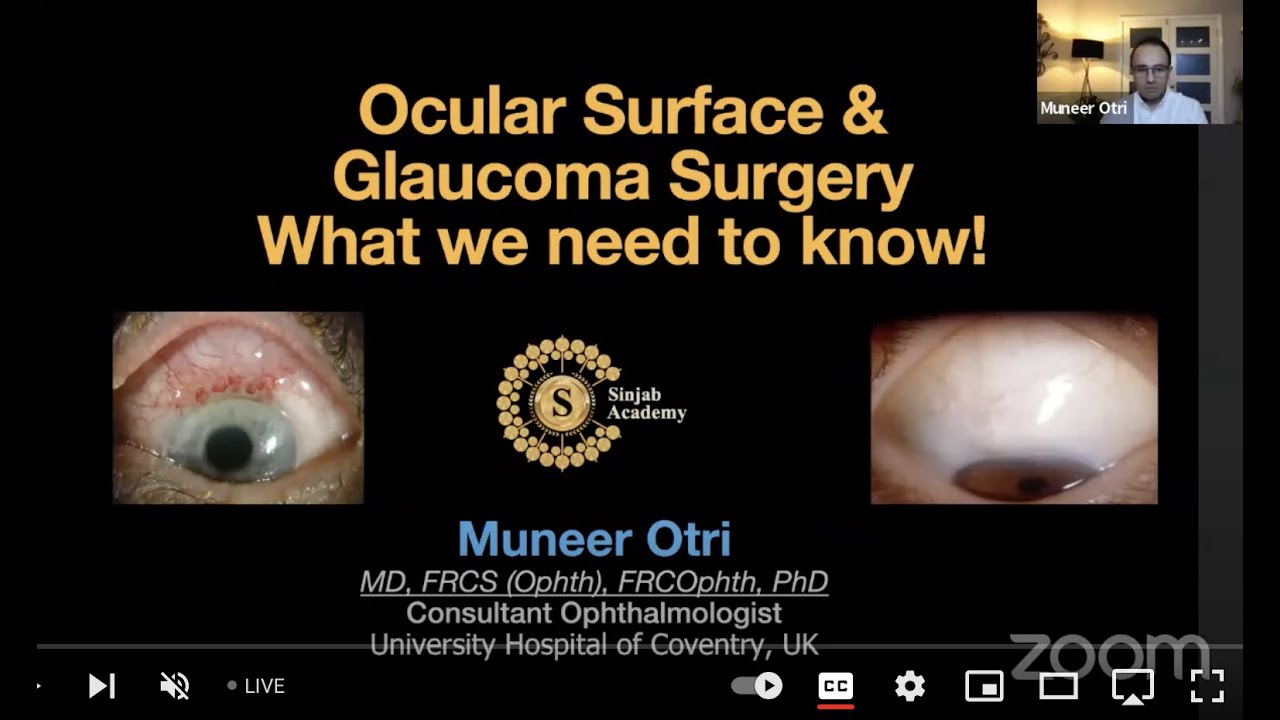 Glaucoma - Taming The Monster - Ocular Surface and Glaucoma Surgery ...