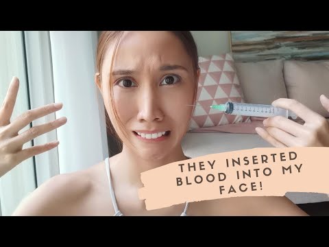 PRP Treatment - Is Injecting Your Own Blood into your face worth the beauty hype?