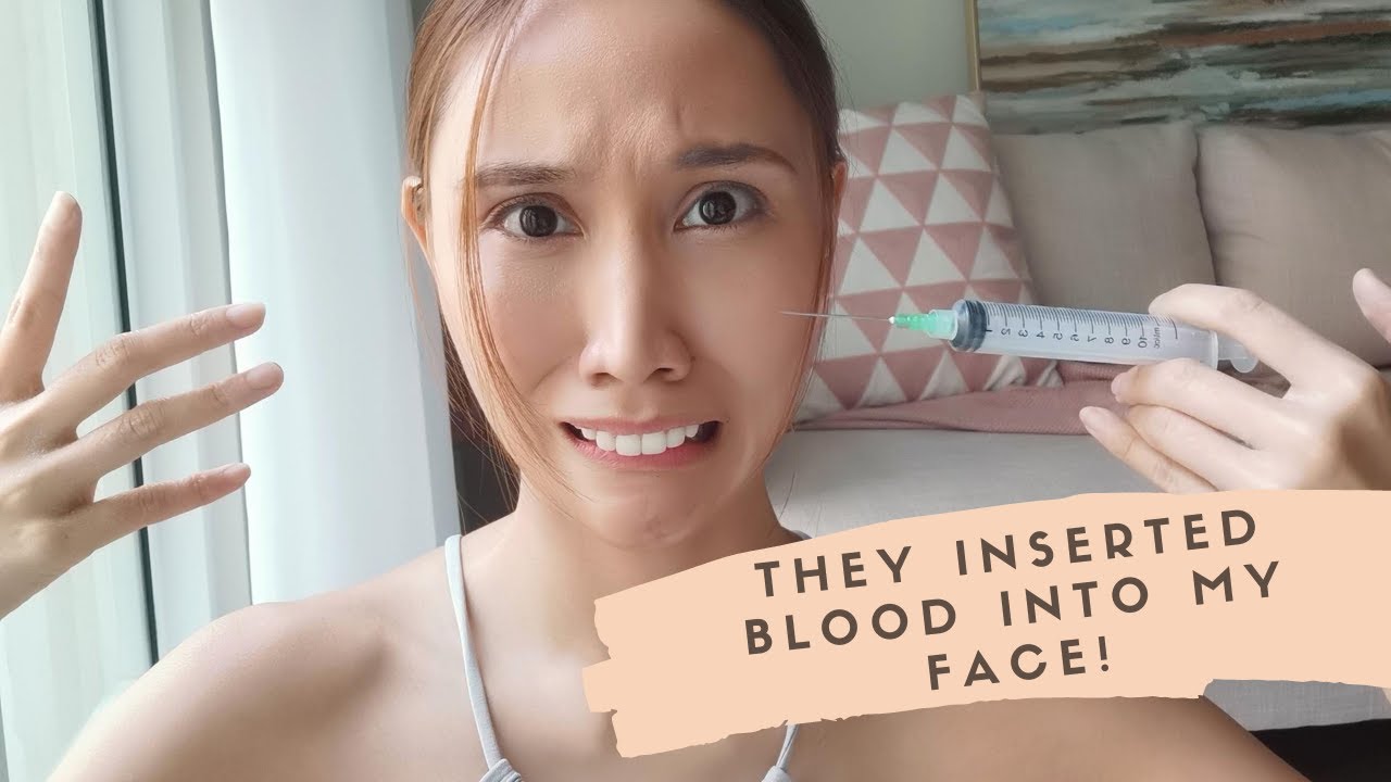 PRP Treatment - Is Injecting Your Own Blood into your face worth the ...