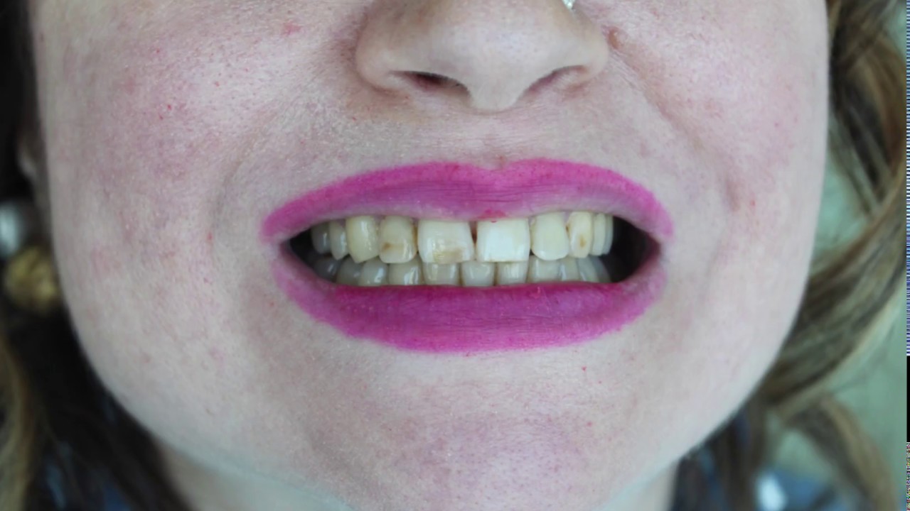 Dance with the teeth !!! - YouTube