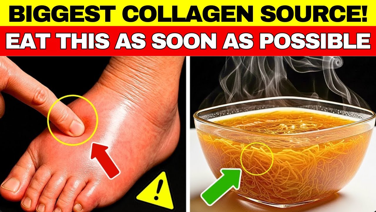 GOODBYE Swelling! 8 Collagen Rich Foods You MUST Eat for Your LEGS and ...