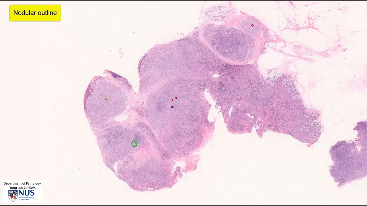 Lymph Node Microscope Slide